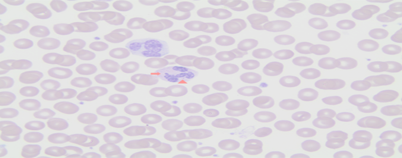 Barr Bodies: Means of sex determination – MARC